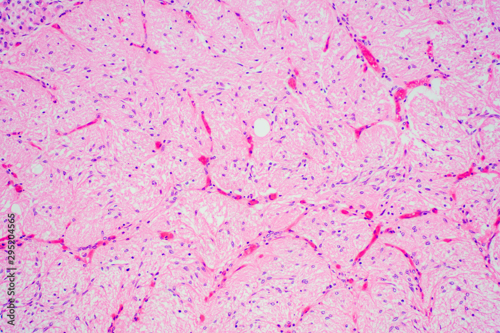 Pituitary gland anatomy under microscope for education pathology. Stock ...