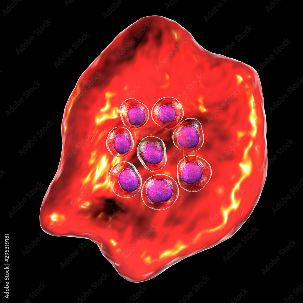 The malaria-infected red blood cell. 3D illustration showing malaria ...