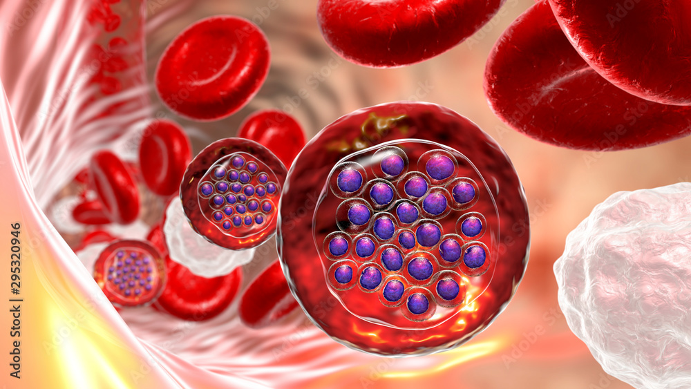 The malaria-infected red blood cells. 3D illustration showing malaria ...