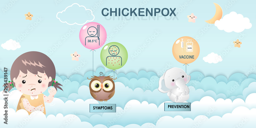 Infographics varicella virus.The kid boy sick chickenpox.Prevention and ...