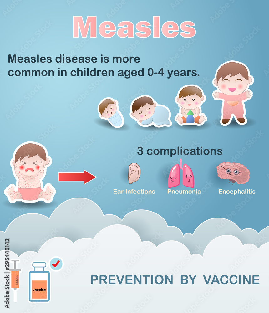 Infographics of Measles.. Kid girl pneumonia with cough and red skin, Health care cartoon ...