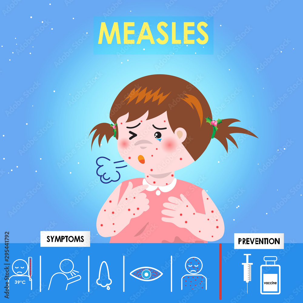 Infographics of Measles.. Kid girl pneumonia with cough and red skin ...