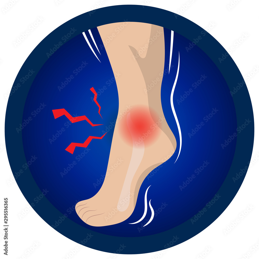 Ankle strain and sprain icon. Vector flat design for radiology ...