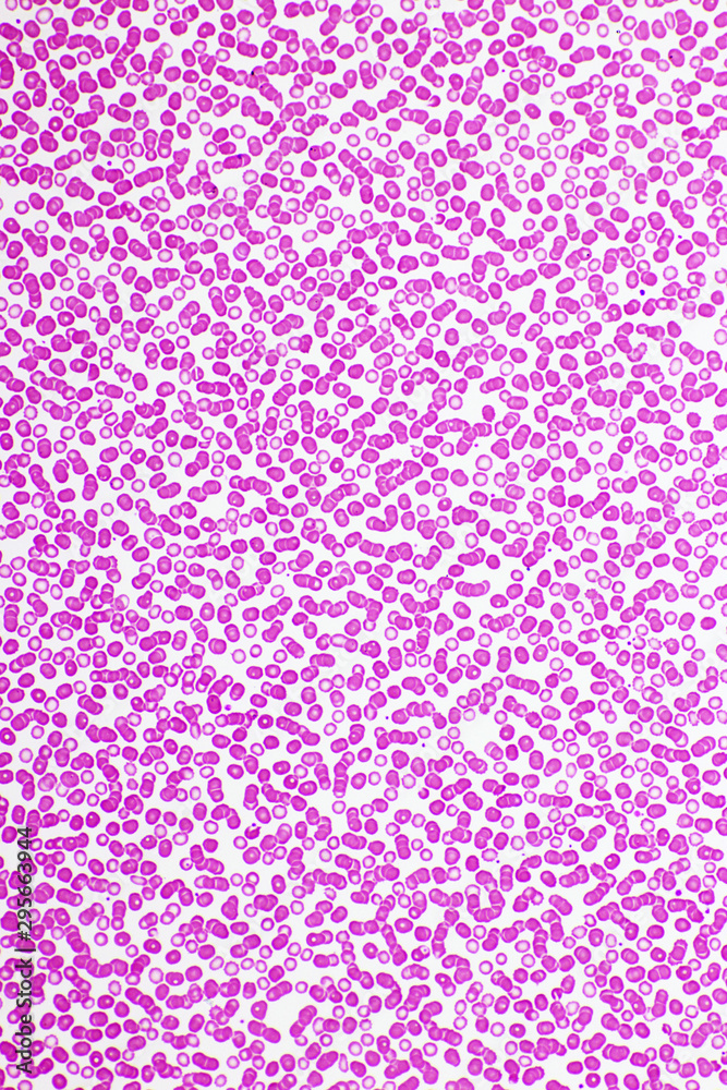 Red blood cells and platelet in blood smear, Wright-Giemsa stain ...