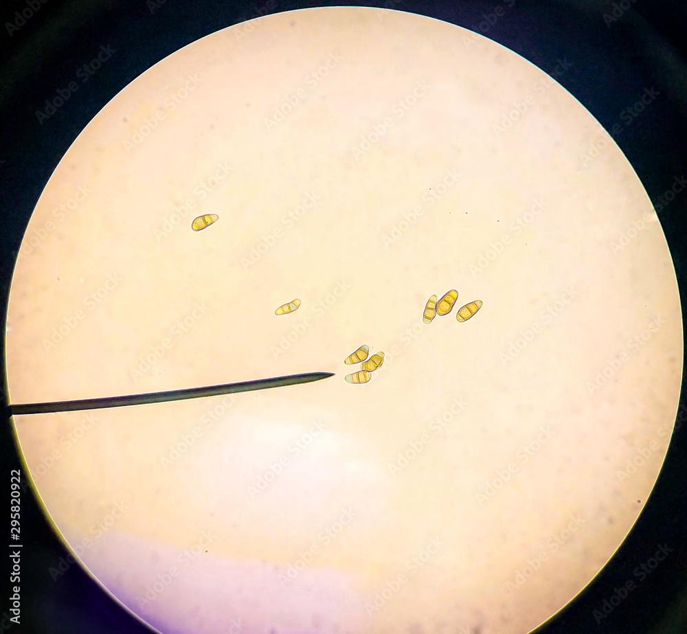 conidia of Curvularia spp. in 40x microscope , Growth on Sabouraud ...