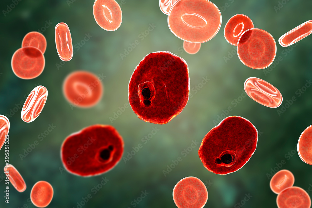 The malaria-infected red blood cells. 3D illustration showing malaria ...