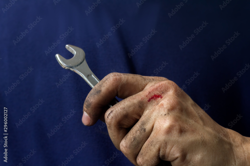 Close up mechanic worker hand and injured at middle finger with scar ...