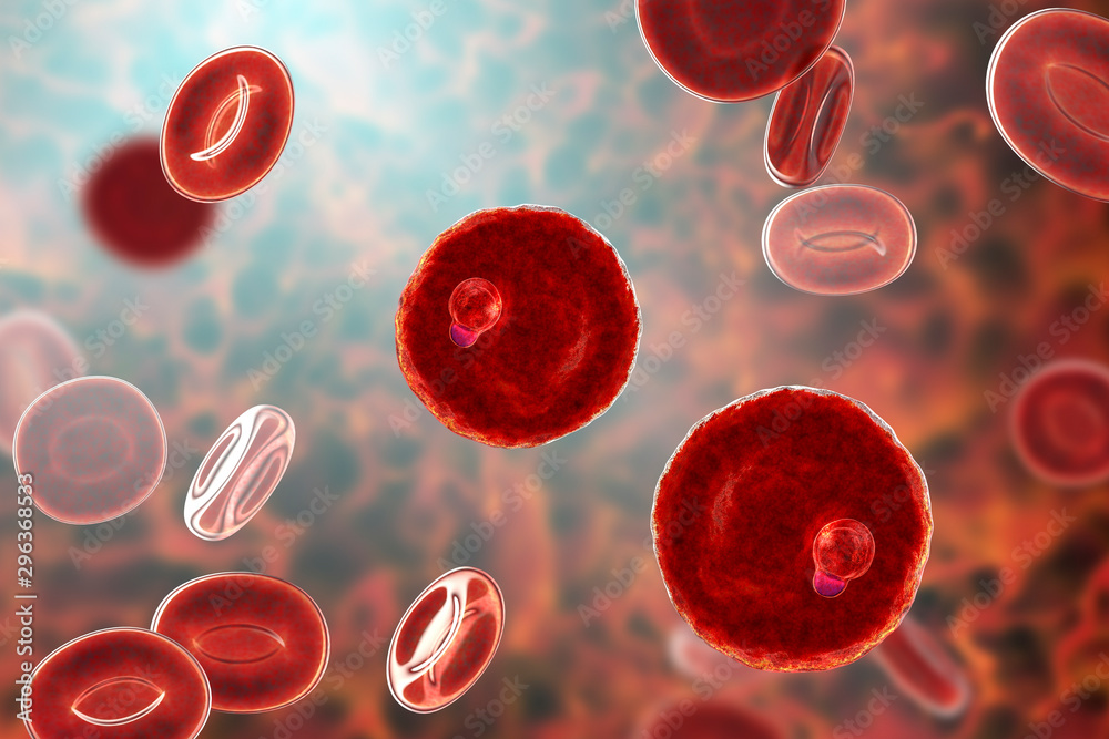 The malaria-infected red blood cell. 3D illustration showing parasite ...