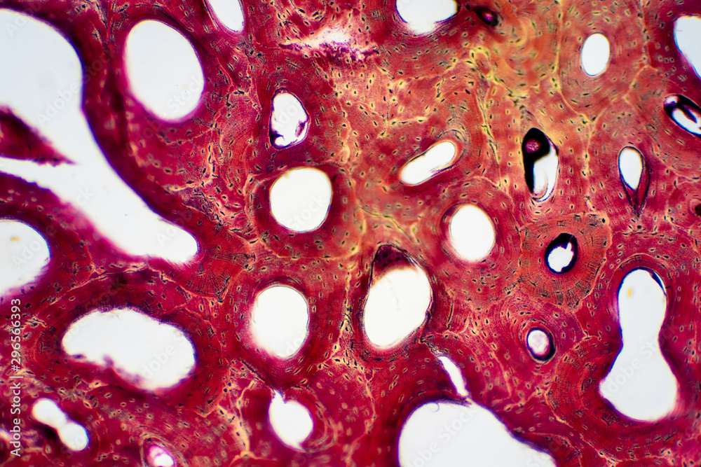 Foto Stock Histology of human compact bone tissue under microscope view ...
