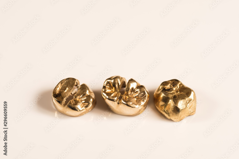Drei goldene Zähne - Zahngold von oben Stock Photo | Adobe Stock