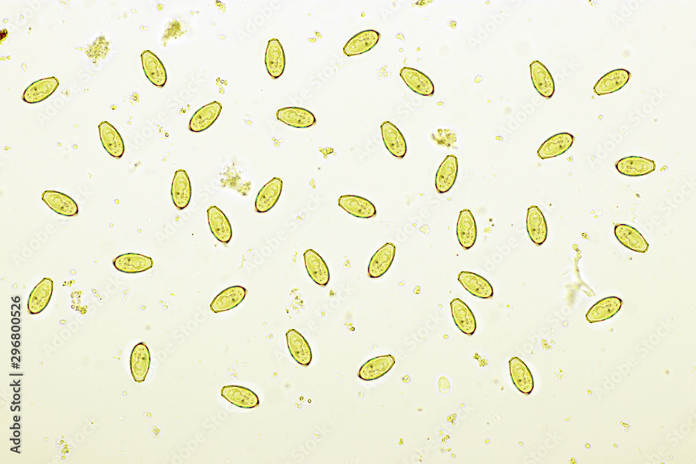 Fluke Under Microscope