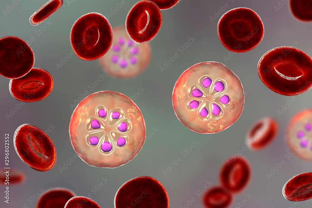The malaria-infected red blood cell. 3D illustration showing parasite ...