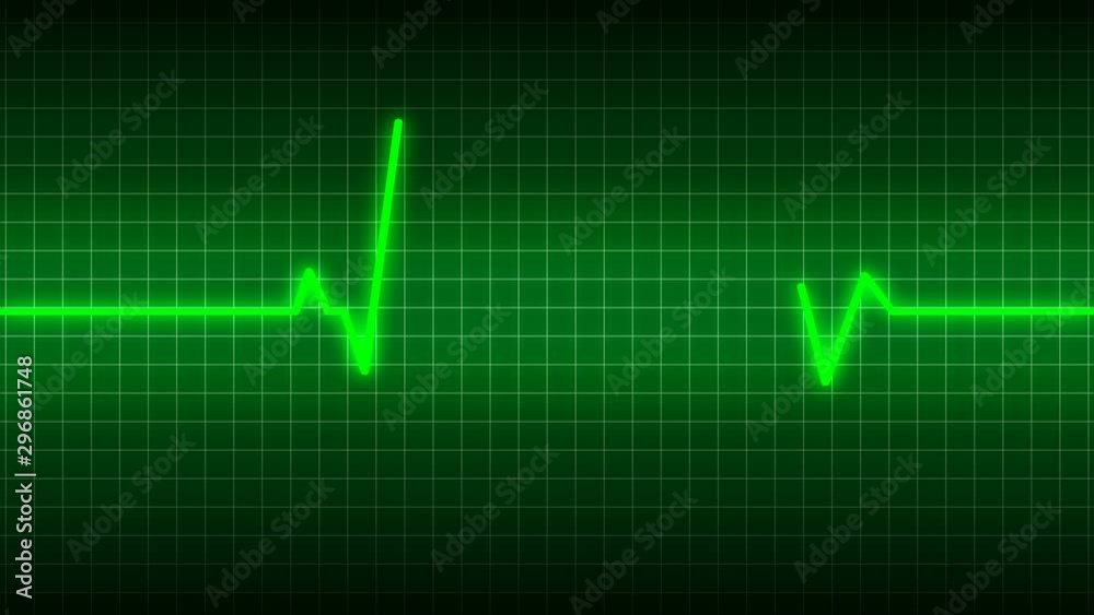 Heart beat cardiogram animation. Heart monitor EKG electrocardiogram ...