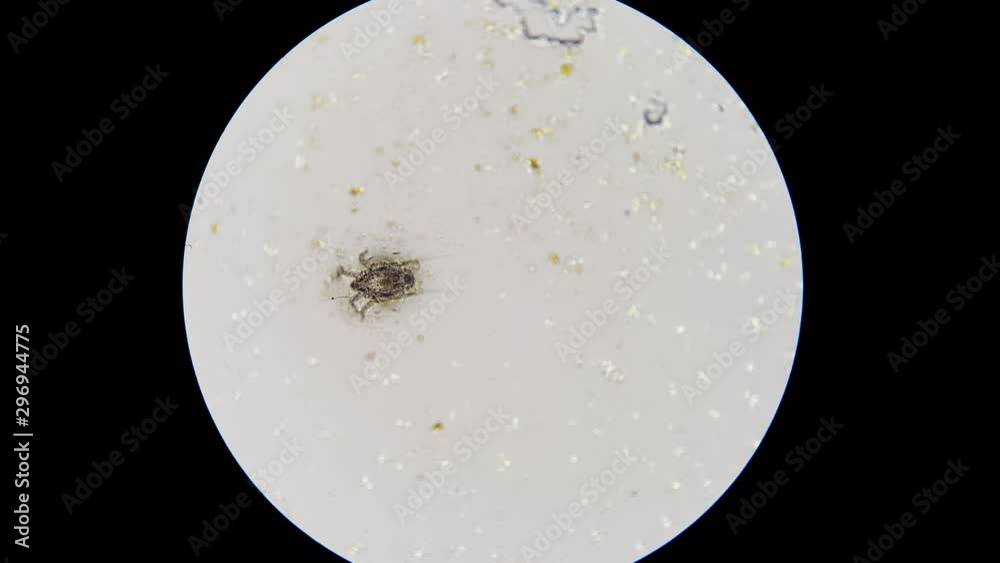 Otodectes cynotis, also known as an ear scabies. Ear swab of a cat's ...