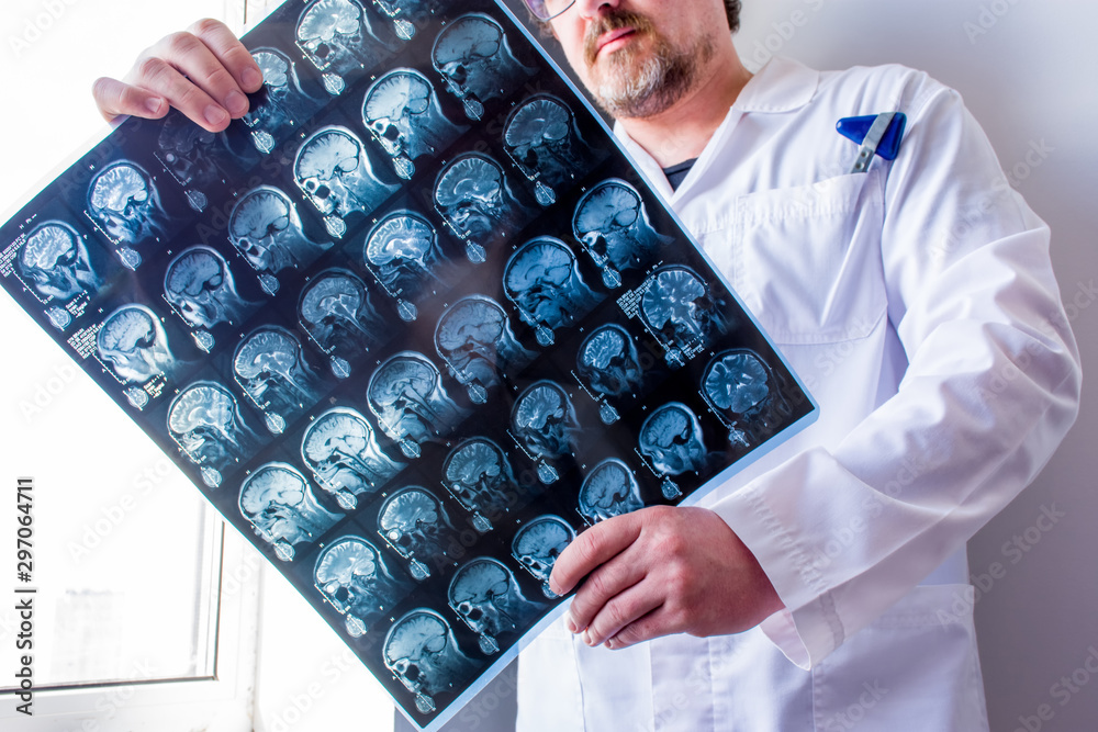 Neurologist or neurosurgeon upright holding MRI brain scanning viewing ...