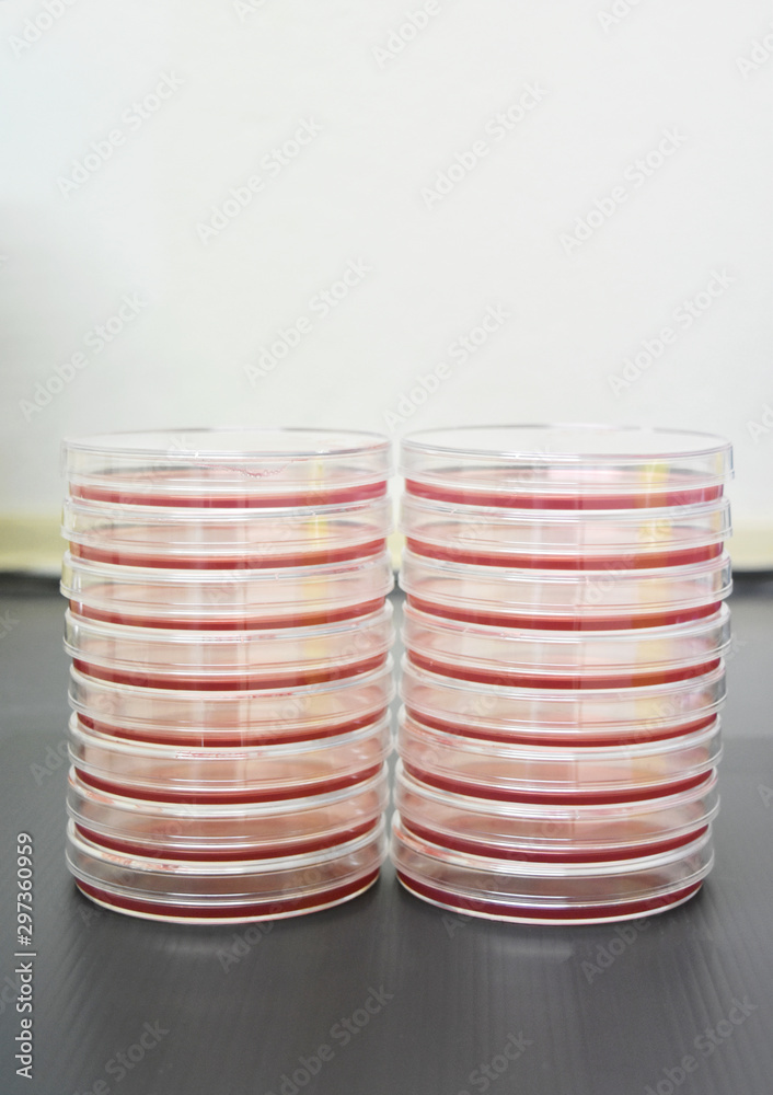 Colonies of bacteria growth on agar plate medium in microbiology ...