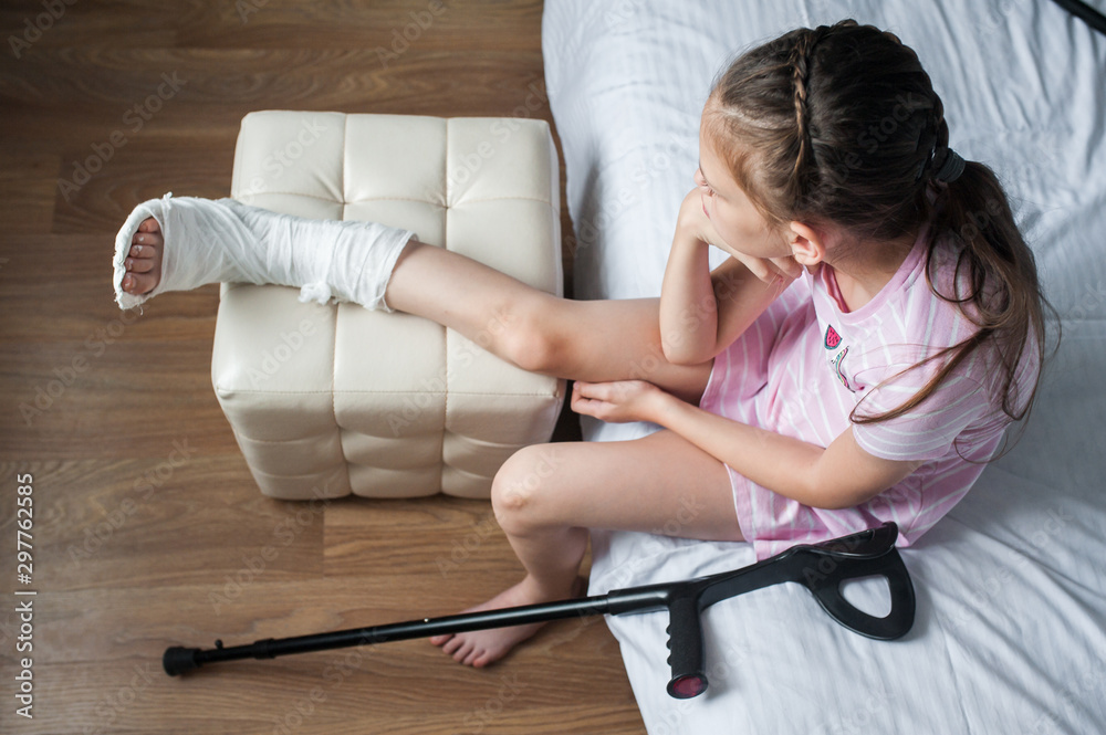 Foto de Girl child with a broken leg in a cast is sitting on a bed with ...