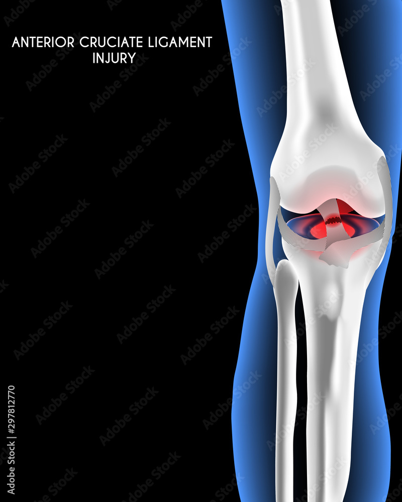 Medical orthopedic abstract background. Treatment for orthopedics ...