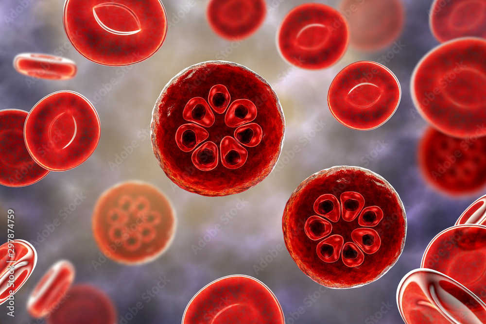 The malaria-infected red blood cell. 3D illustration showing parasite ...