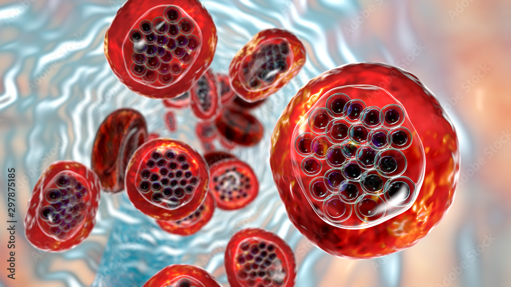 The malaria-infected red blood cells. 3D illustration showing parasite ...