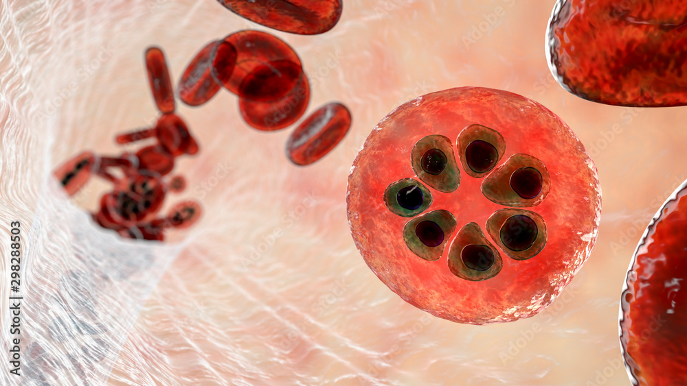 The malaria-infected red blood cell. 3D illustration showing parasite ...