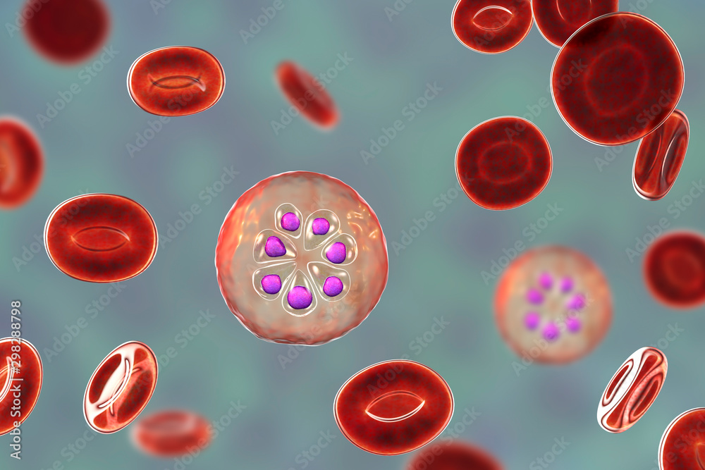 The malaria-infected red blood cell. 3D illustration showing parasite ...