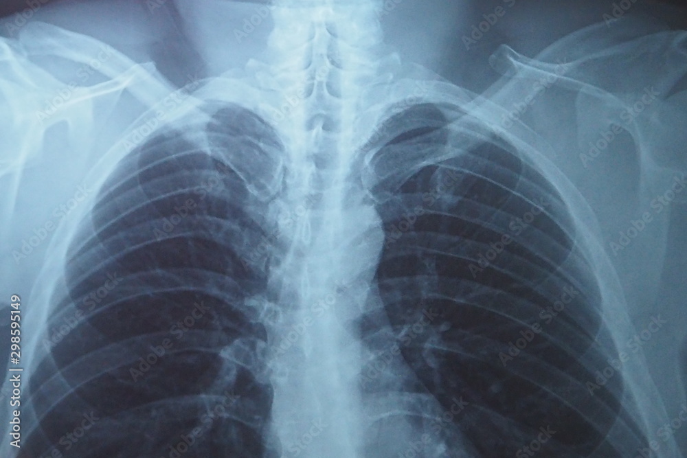 X-Ray film of human skeletal system anatomy displays radiographic image ...