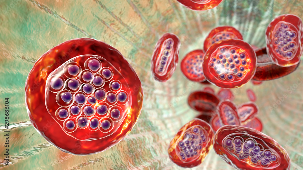 The malaria-infected red blood cells. 3D illustration showing parasite ...