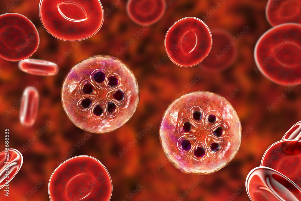 The malaria-infected red blood cell. 3D illustration showing parasite ...