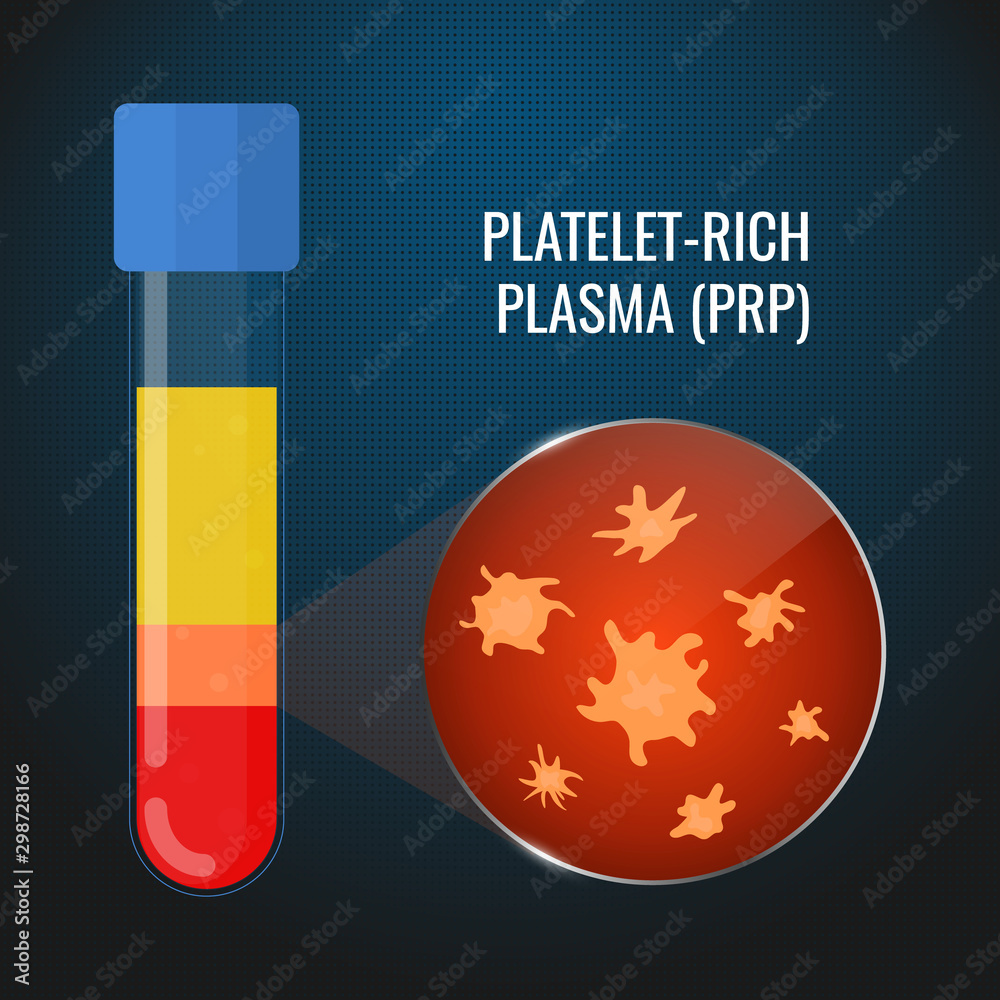 Close up of platelet-rich plasma structure under microscope ...