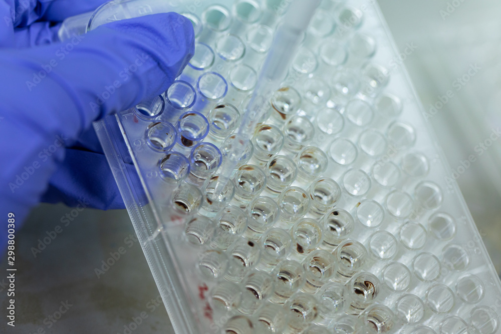 Study of fish blood composition with 96 wells microplate for laboratory ...
