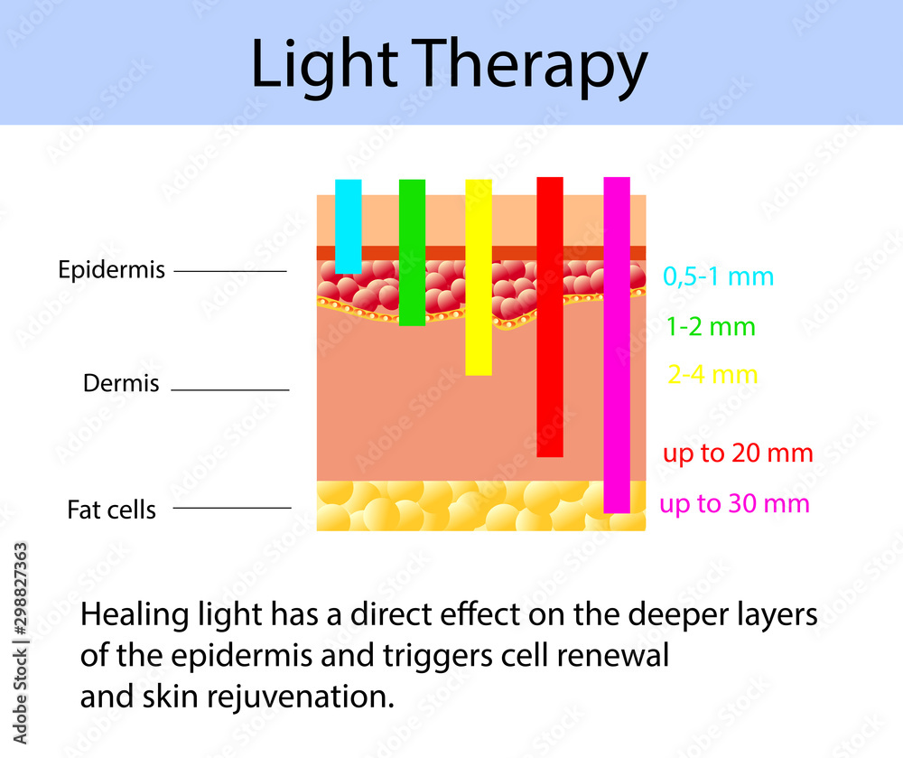 Light therapy diagram, vector illustration with length of waves Stock ...