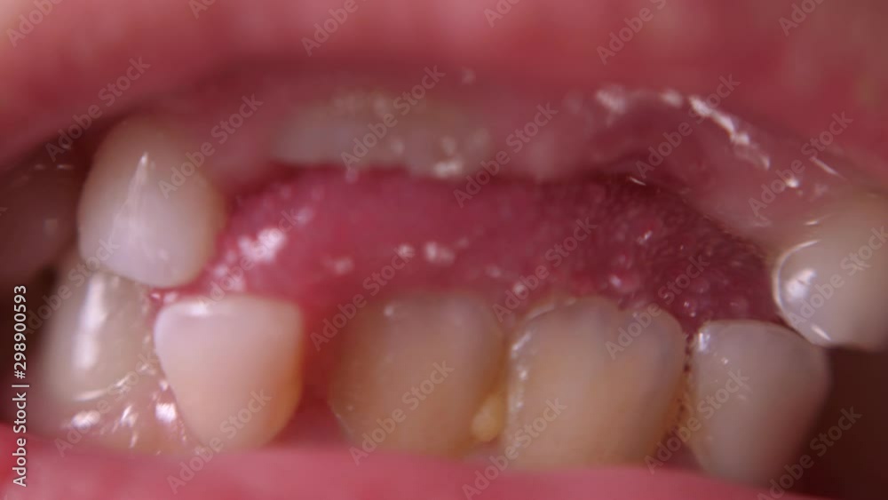 Baby teeth macro shoot. Toothless smile. A wobbly tooth. Cutting root ...