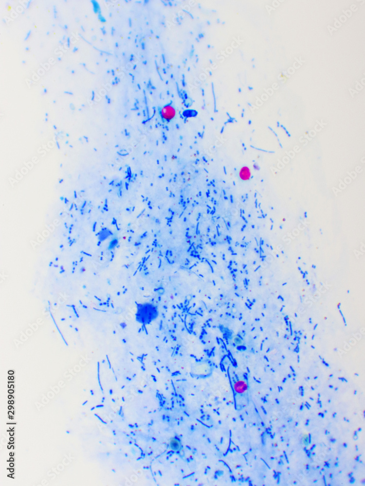 Foto de Cryptosporidium parvum protozoa positive (red sphere shape) in ...