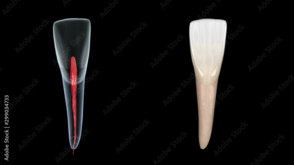 Dental root anatomy - Central maxillary incisor tooth. Medically ...