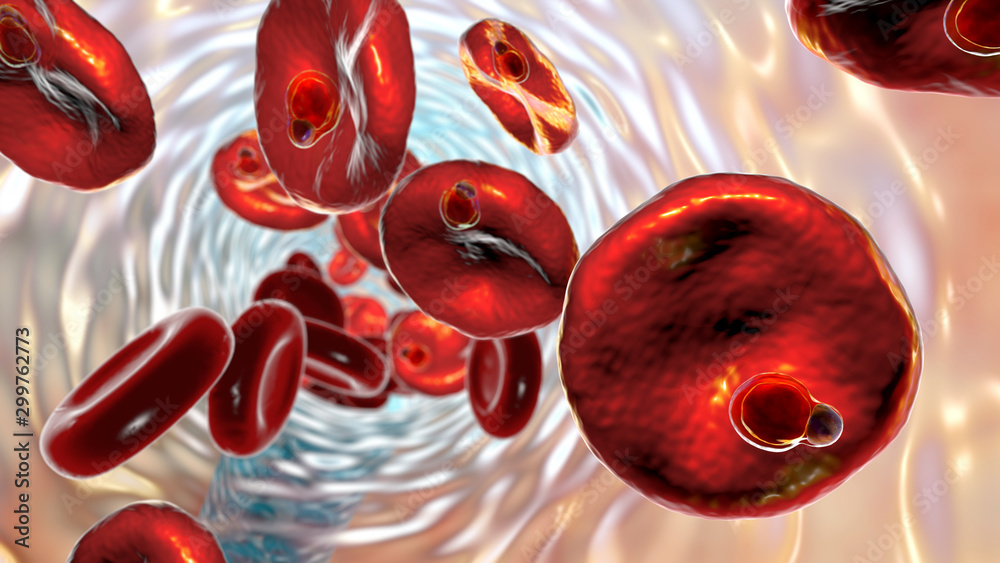 ภาพประกอบสต็อก The malaria-infected red blood cells. 3D illustration ...