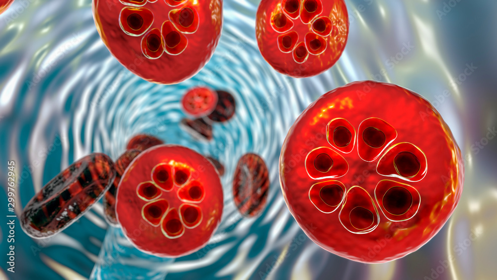 The malaria-infected red blood cell. 3D illustration showing parasite ...