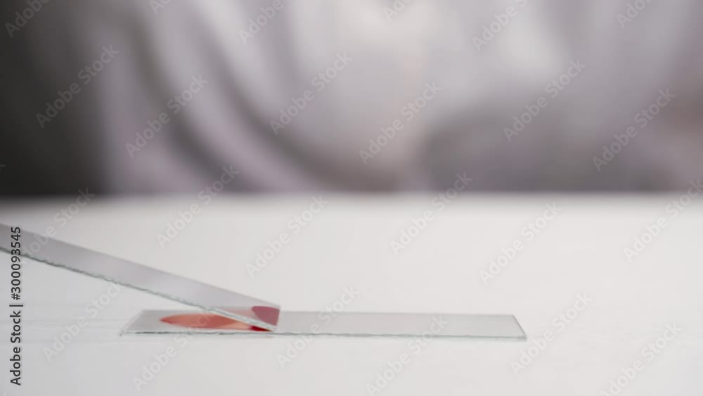 A close-up shot is a blood test procedure in a laboratory. Lab ...