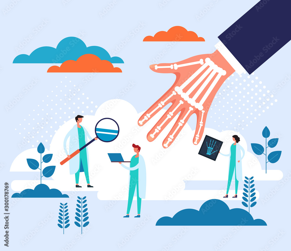 Hand arm x ray radiography medicine concept. Vector flat graphic design ...