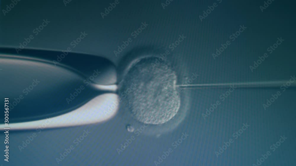 Egg cell is getting fertilized under a microscope. IVF, extracorporal ...