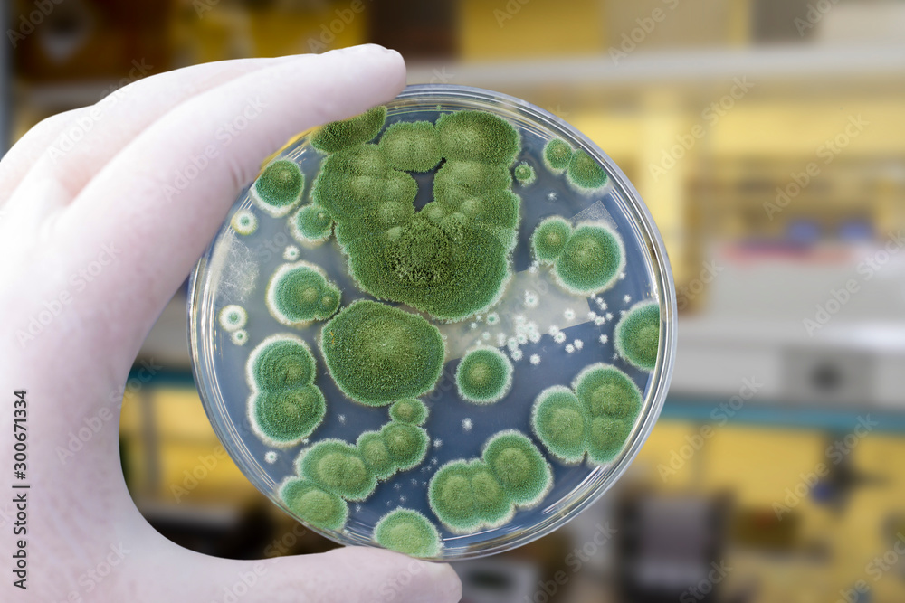 Colonies of different mold fungi grown from indoor air Stock Photo ...