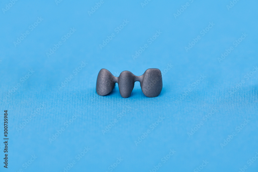 Poster Dental silver metal tooth crowns – Wall Art | UkPosters