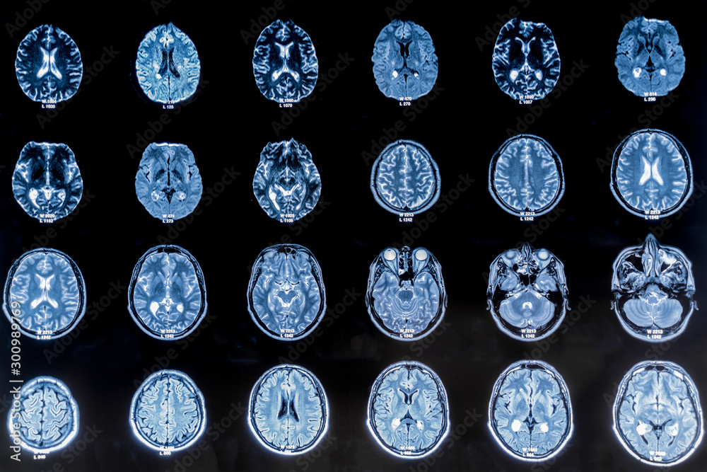 Series of CAT Scans showing the human head. Examination, treatment ...