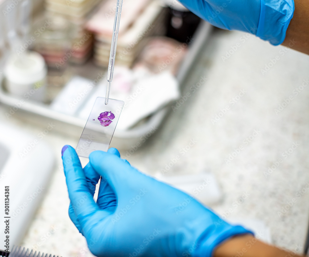 Pathological specimen preparation to detect abnormalities at the ...