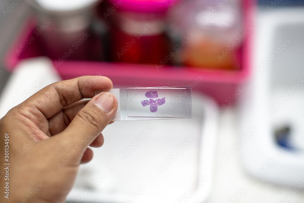 Pathological specimen preparation to detect abnormalities at the ...