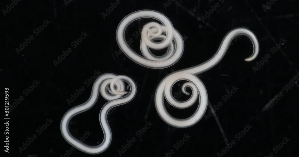 Ascariasis is a disease caused by the parasitic roundworm Ascaris ...