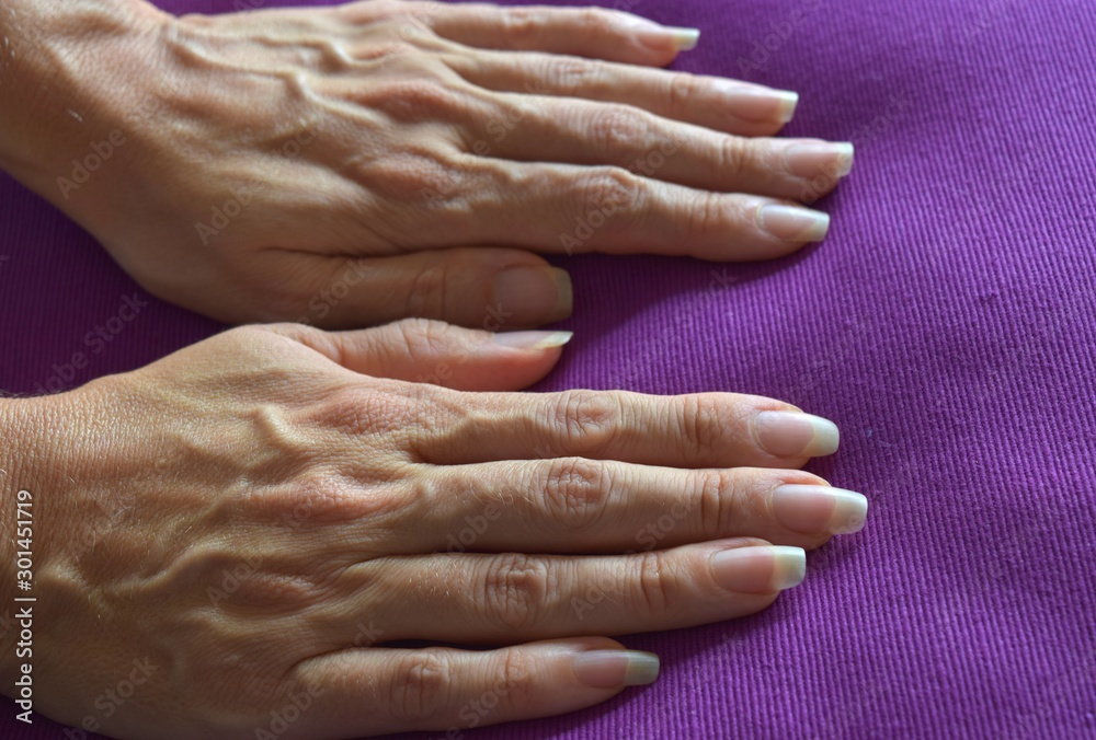 Female hands with ugly veins and long nails of different length Stock ...