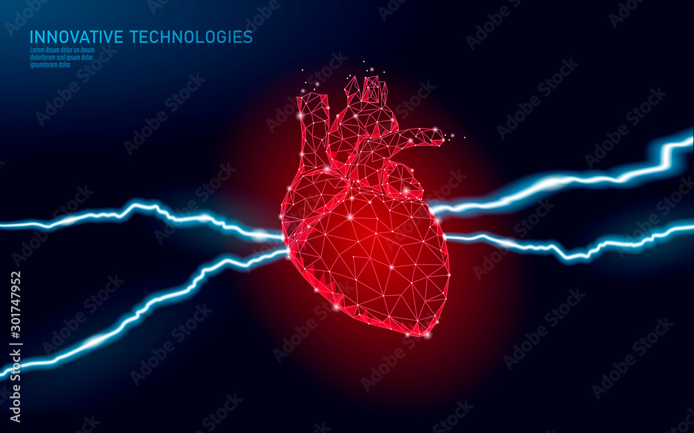 3D medicine heart attack warning. Human health diagnostics vascular ...