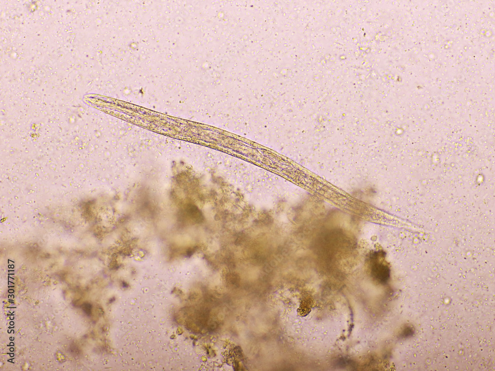 Strongyloides stercoralis or threadworm in human stool, analyze by ...