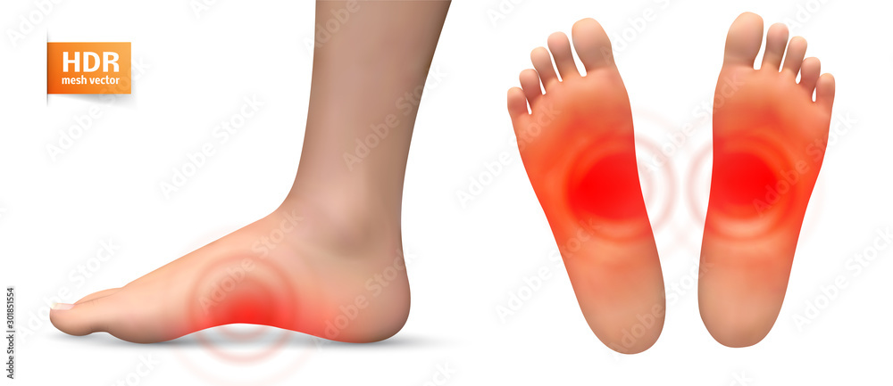 vector human foot.red spots of pain. ready element for medicine and ...